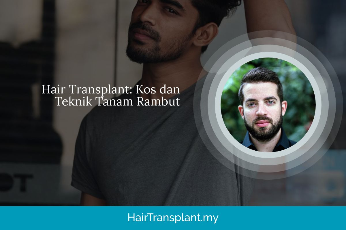 Hair Transplant: Kos dan Teknik Tanam Rambut