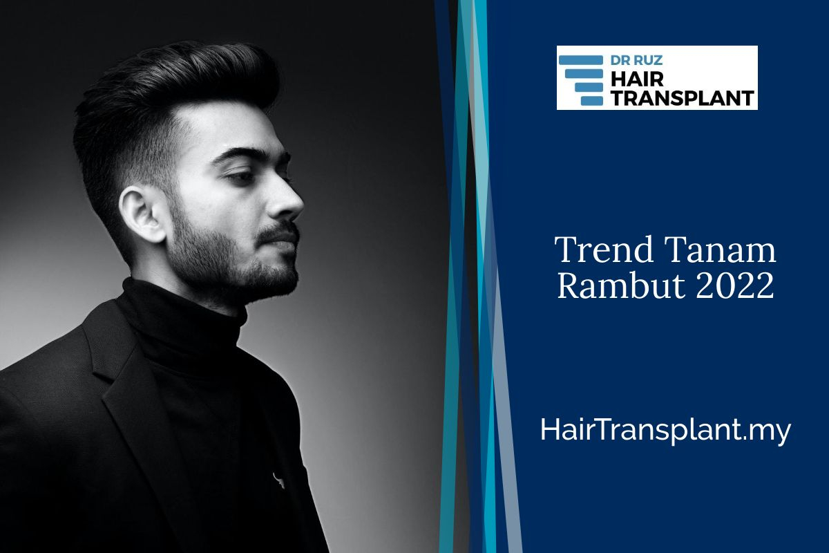 Trend Tanam Rambut 2022 – Hair Transplant Malaysia