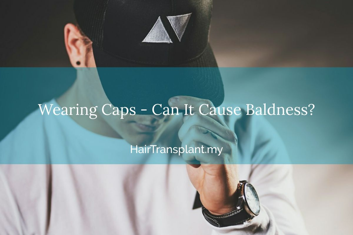 Wearing Caps – Can It Cause Baldness? – Hair Transplant Malaysia