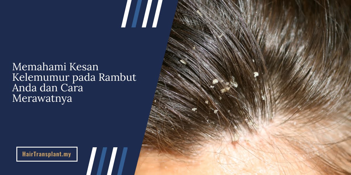 Memahami Kesan Kelemumur pada Rambut Anda dan Cara Merawatnya – Hair ...