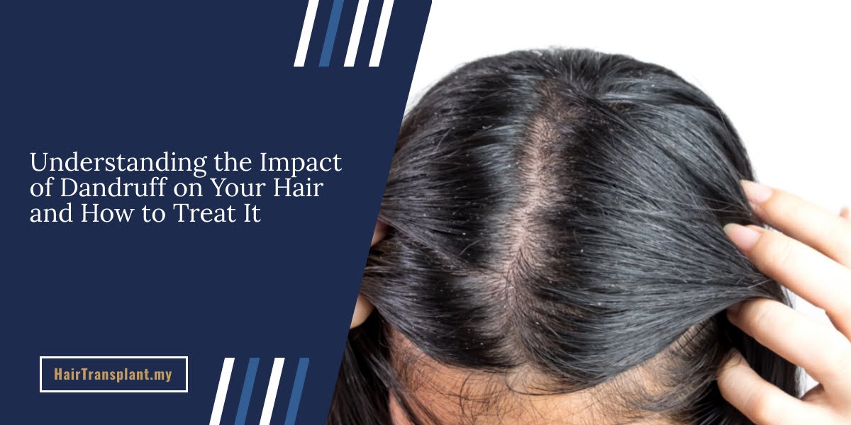 Understanding the Impact of Dandruff on Your Hair and How to Treat It ...